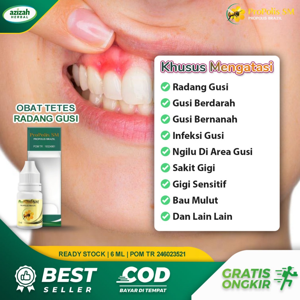 Jual Obat Radang Gusi Bengkak Merah Berdarah Bernanah Infeksi Syaraf Gusi Gigi Terasa Ngilu ...