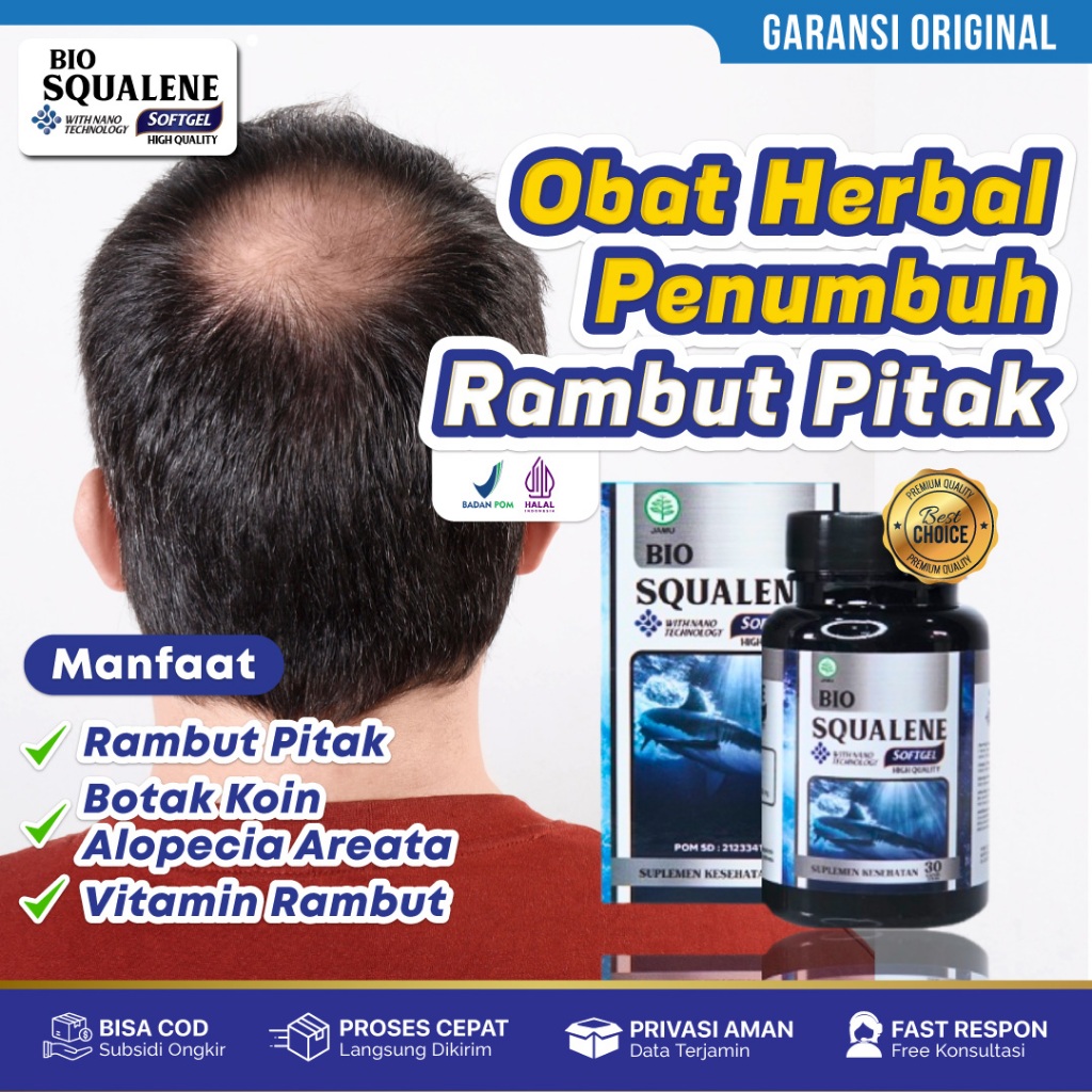 Jual Obat Alopecia Areata Penumbuh Rambut Botak Koin Pitak Bio Squalene ...