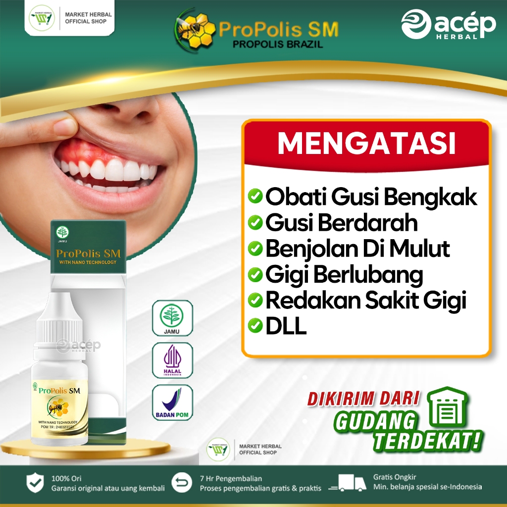 Jual Obat Gusi Bengkak Gusi Berdarah Gigi Berlubang Abses Gigi Gusi ...