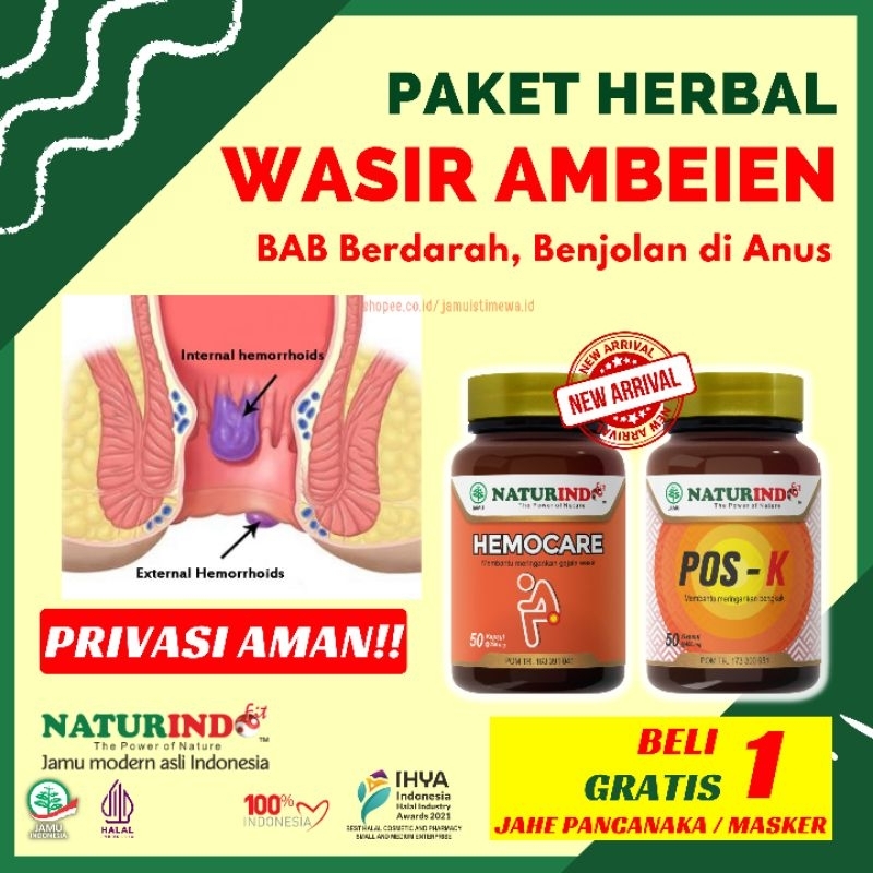 Jual Obat Ambeien Wasir Benjolan di Anus BAB Berdarah Ampuh Herbal Ambeyen Ambeien Wasir Stadium ...