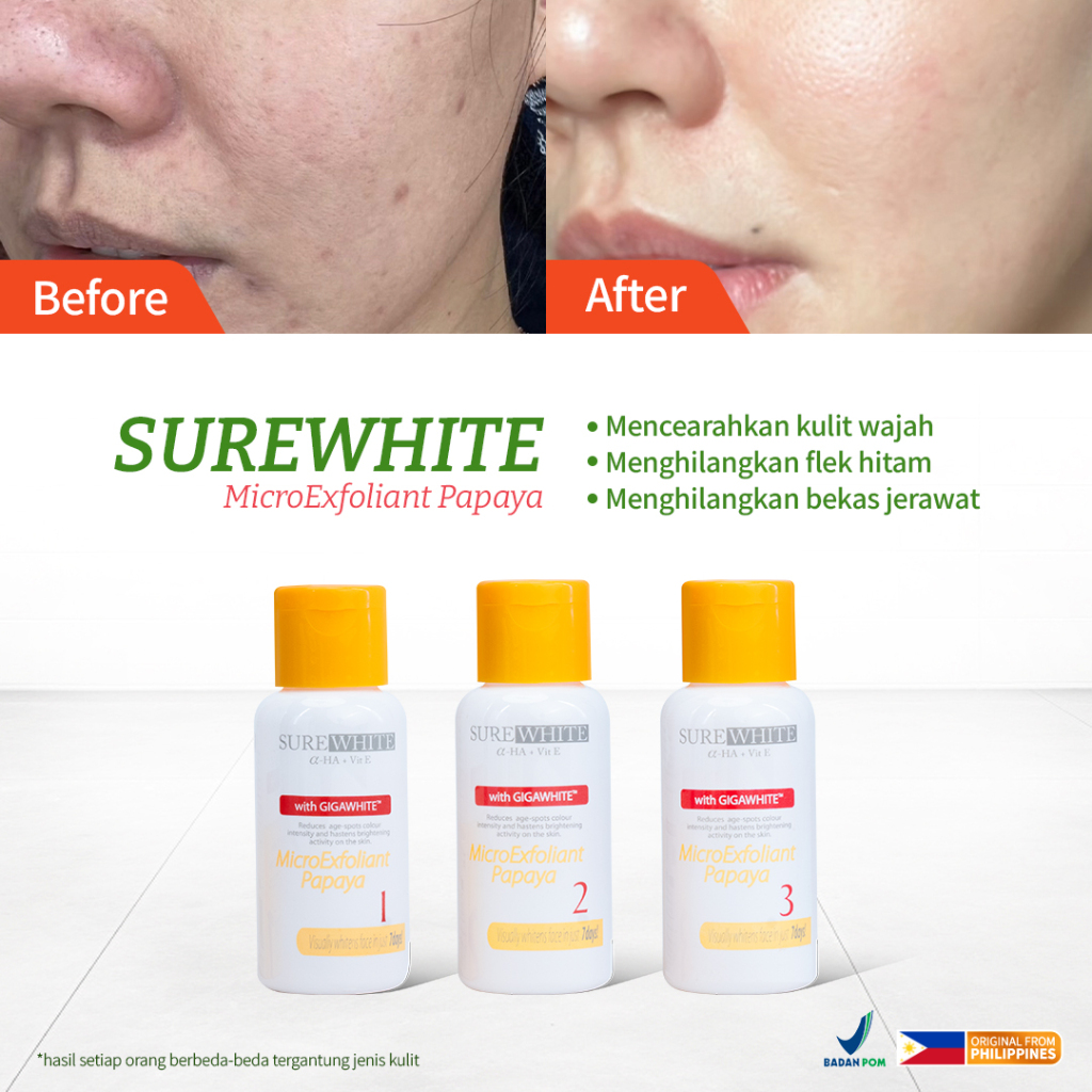 Jual RDL Surewhite Microexfoliant Toner RDL No 1 2 3 Memperbaiki Wajah ...