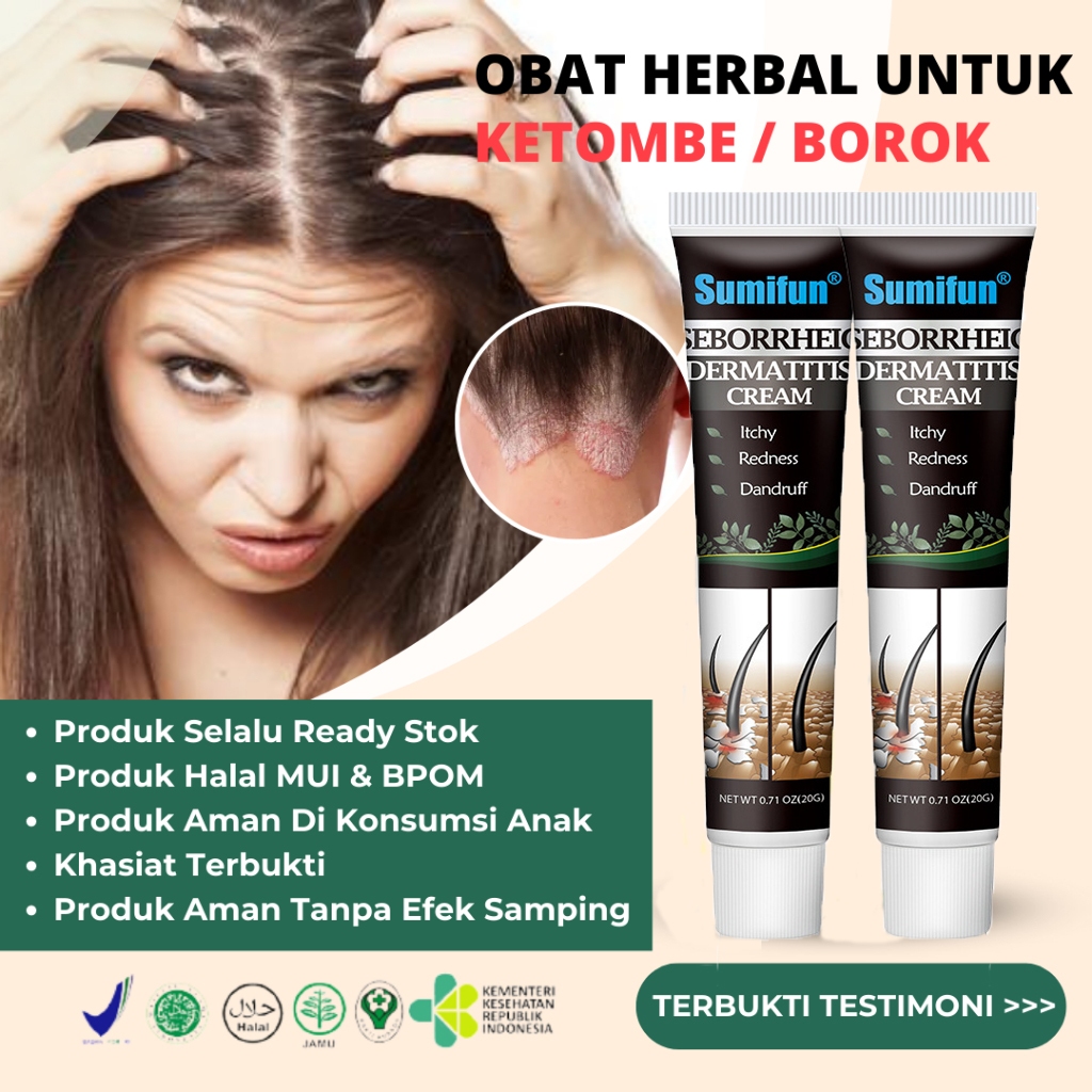 Jual OBAT KETOMBE PARAH Scalp Itching dan Dandruff Rambut rontok Anti Ketombe cream | Shopee ...
