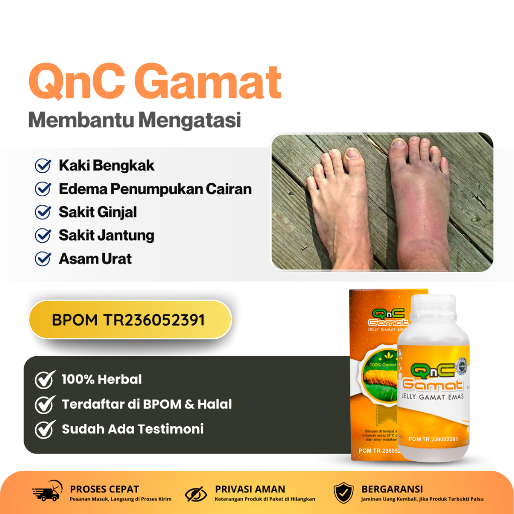 Jual QnC Gamat - Obat Kaki Bengkak Karena Ginjal, Obat Edema Kaki, Obat ... Jual QnC Gamat - Obat Kaki Bengkak Karena Ginjal, Obat Edema Kaki, Obat ...