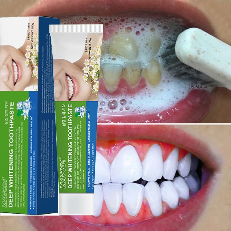 Jual Odol MAVCDl 【Beli 1 gratis 2】Pemutih gigi Pasta gigi Memperbaiki ...