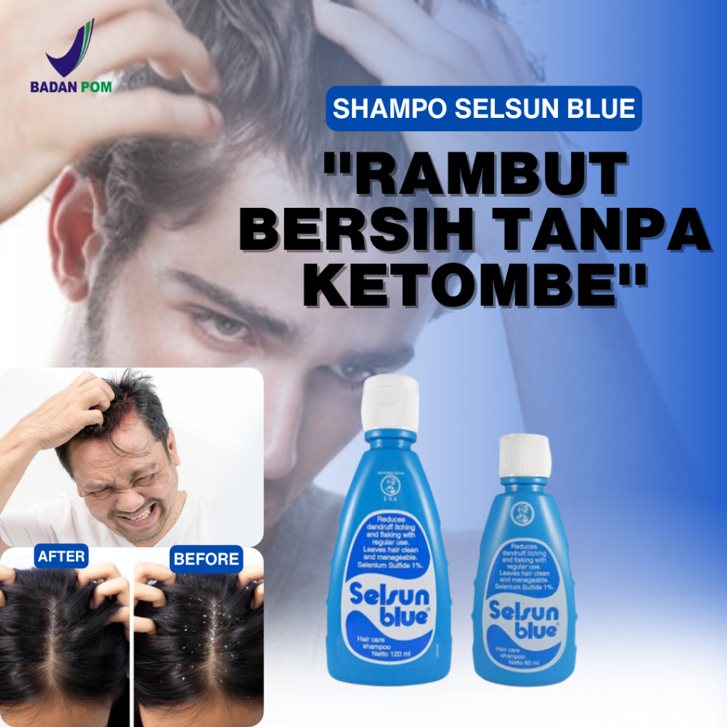 Jual Selsun Blue Shampoo Pemanjang Rambut Cepat Rontok Parah Ketomed ...