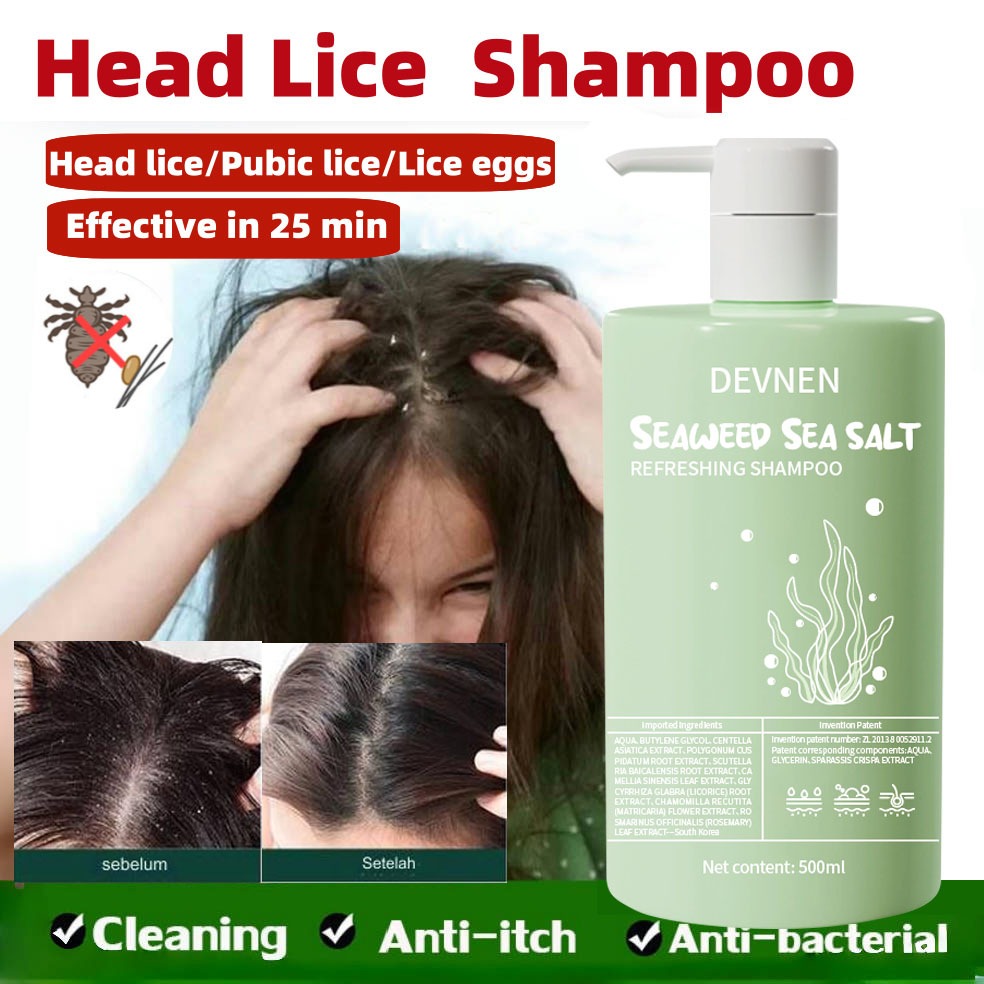 Jual Shampo buat ketombe penghilang anti gatal pengobatan tungau amino memperbaiki rambut 500ML ...