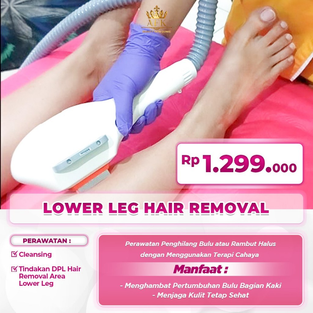 Jual Lower Leg Hair Removal | Shopee Indonesia