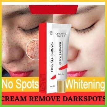 Jual Cinddynal Niacinamide Skin Whitening Freckle Cream Remove Dark Spots Penghilang Flek ...