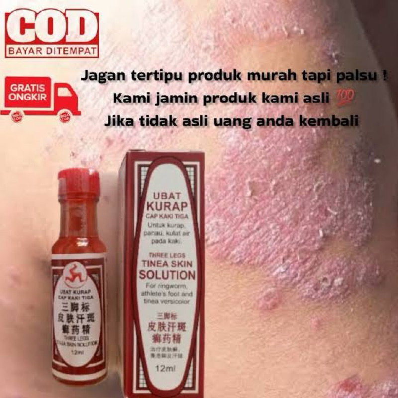 Jual Obat Kurap Cap Kaki Tiga Cair 12ml Merah Original Malaysia ...