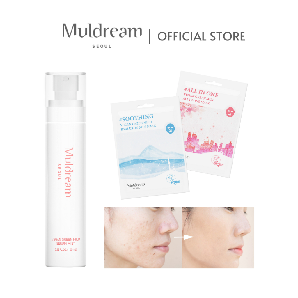 Jual Muldream No Breakouts Just Glow Bundle Set | Shopee Indonesia