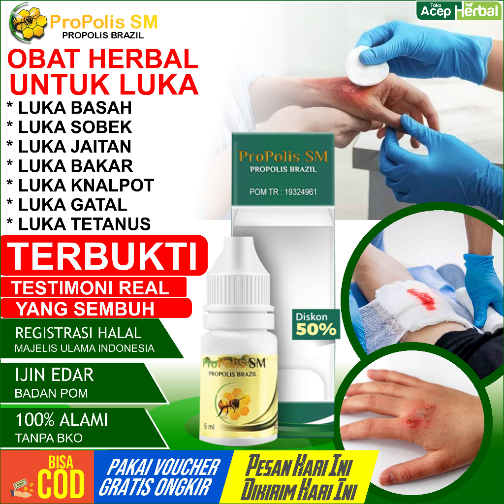 Jual Obat Luka Basah Luka Kering Luka Bakar Luka Diabetes Luka Pasca ...