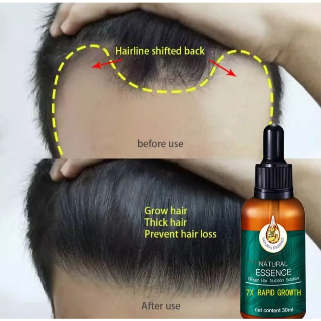 Jual EELHOE Semprotan Penumbuh Rambut Hair Growth Serum Hair Growth ...