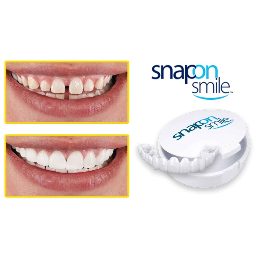Jual Snap On Smile Original Authentic Gigi Palsu Snapon Smile 1 Set Veneer Gigi palsu | Shopee ...