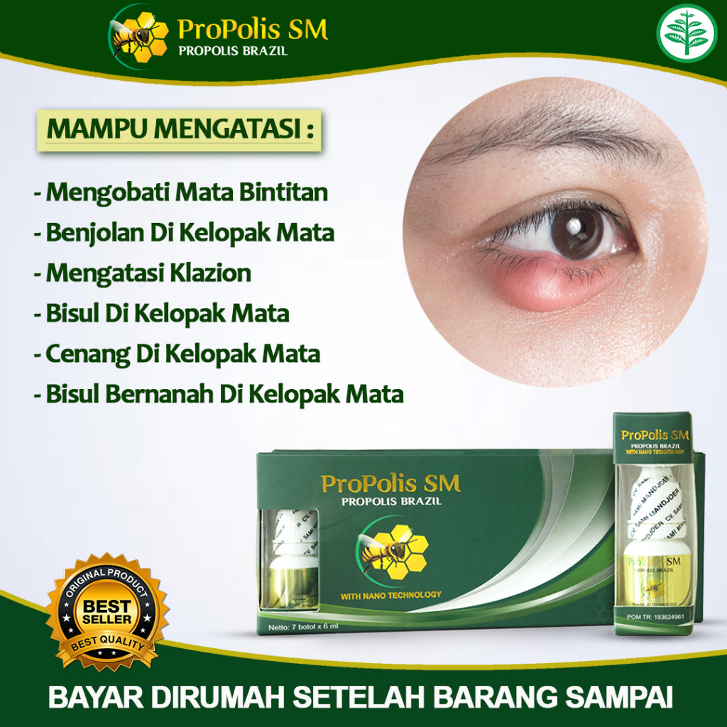 Jual Obat Mata Bintitan, Benjolan Kelopak Mata, Bisul Dikelopak Mata ...