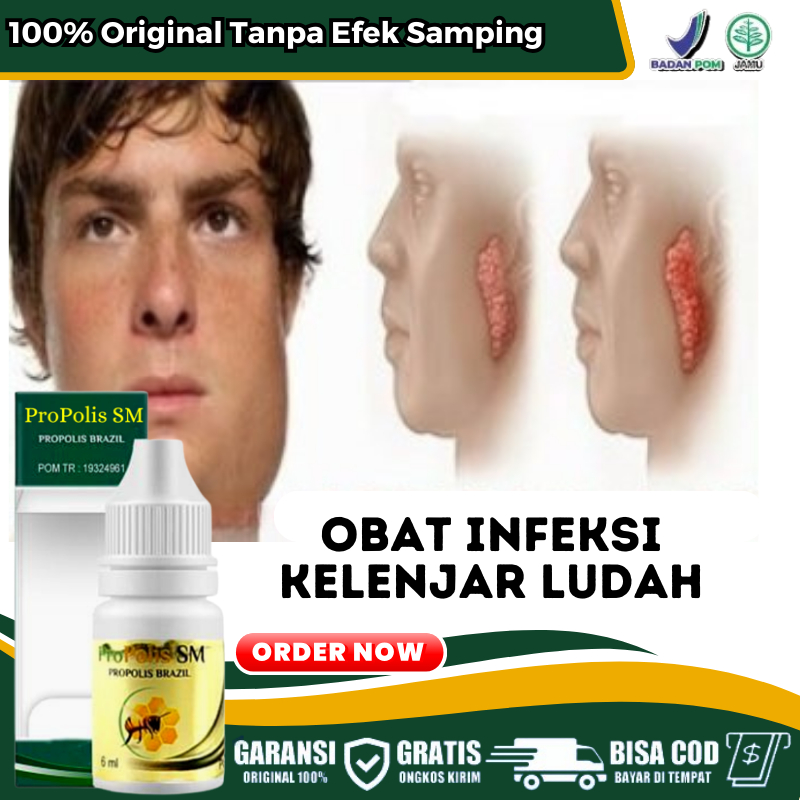 Jual Obat Infeksi Kelenjar Ludah, Pembengkakan di Rahang, Obat ...