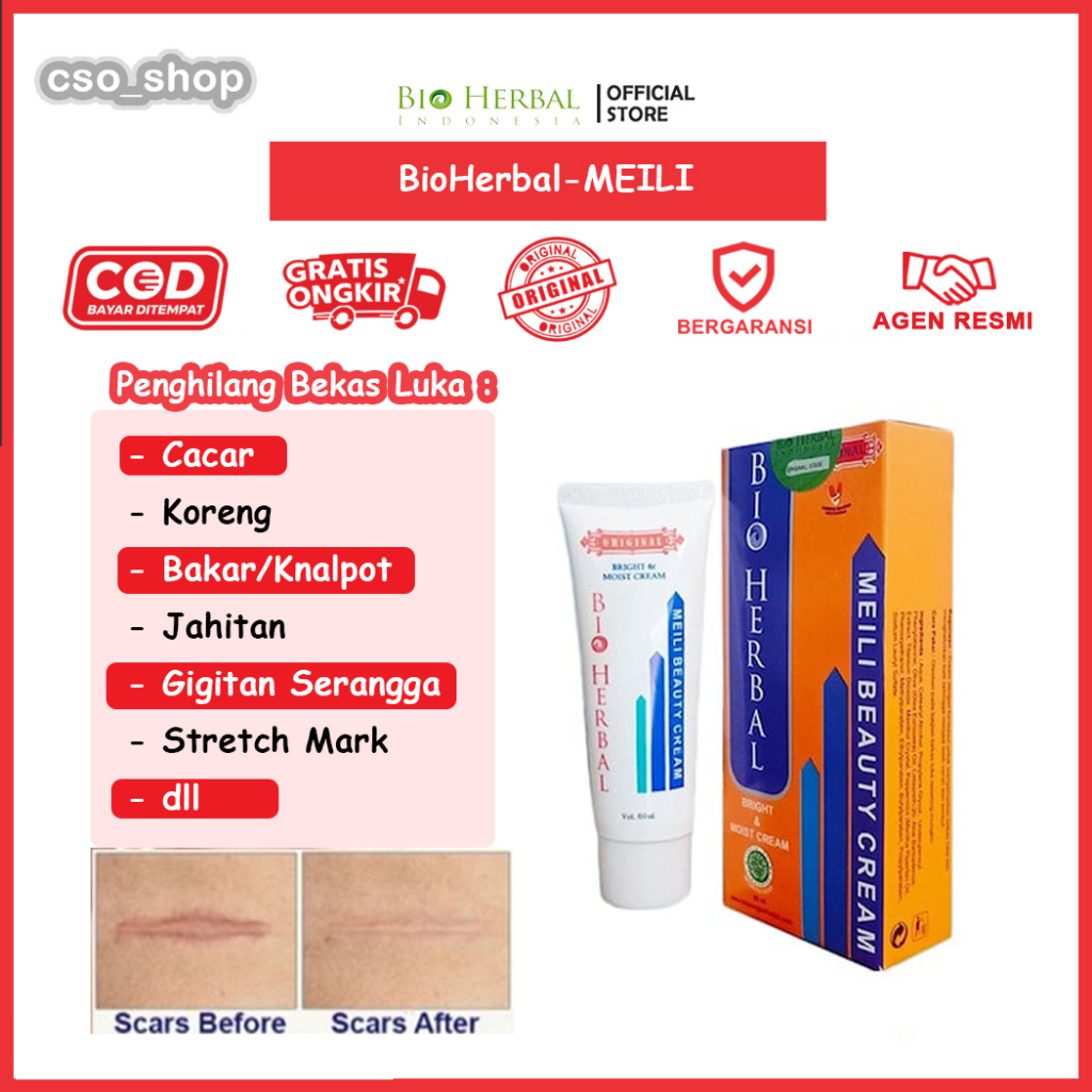 Jual BIO HERBAL Meili Beauty Cream Meilibahenling Salep Penghilang ...