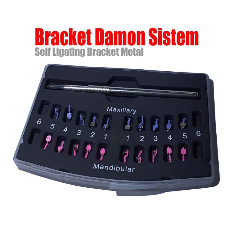 Jual bracket DAMON SYSTEM SELF LIGATING behel DAMON | Shopee Indonesia