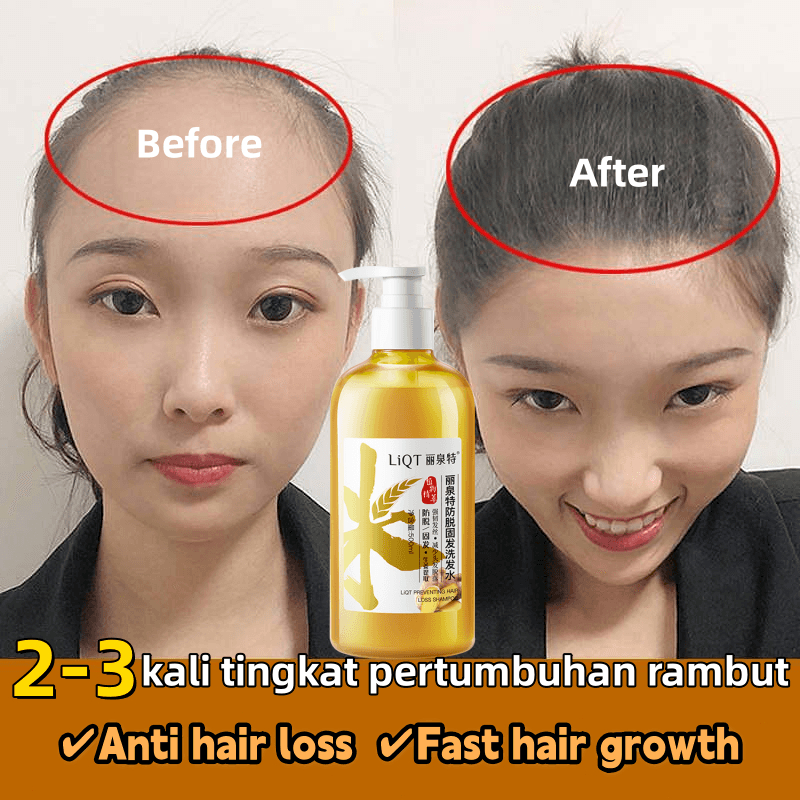 Jual Shampo penumbuh rambut cepat-Shampoo anti ketombe dan rontok-Shampo anti rontok-Sampo ...