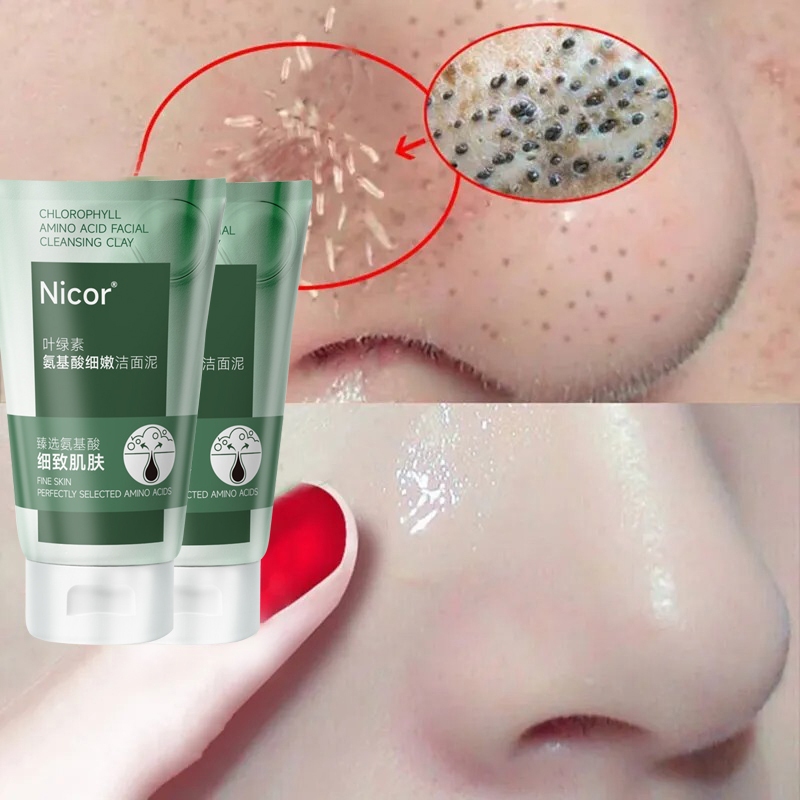 Jual Amino Acid Cleanser Pembersih Wajah Jerawat Facial Wash Penghilang ...