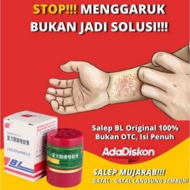 Jual Salep Obat Kulit Gatal Selangkangan Alergi Kulit Kadas Kurap Eksim ...