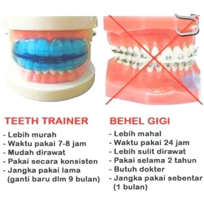 Jual Perapih Gigi / Cetak Gigi rapi / Orthodontic retainer teeth ...