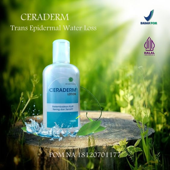 Jual Ceraderm Lotion Bpom Mengatasi Kulit Kering Dan Sensitif 100 ml ...