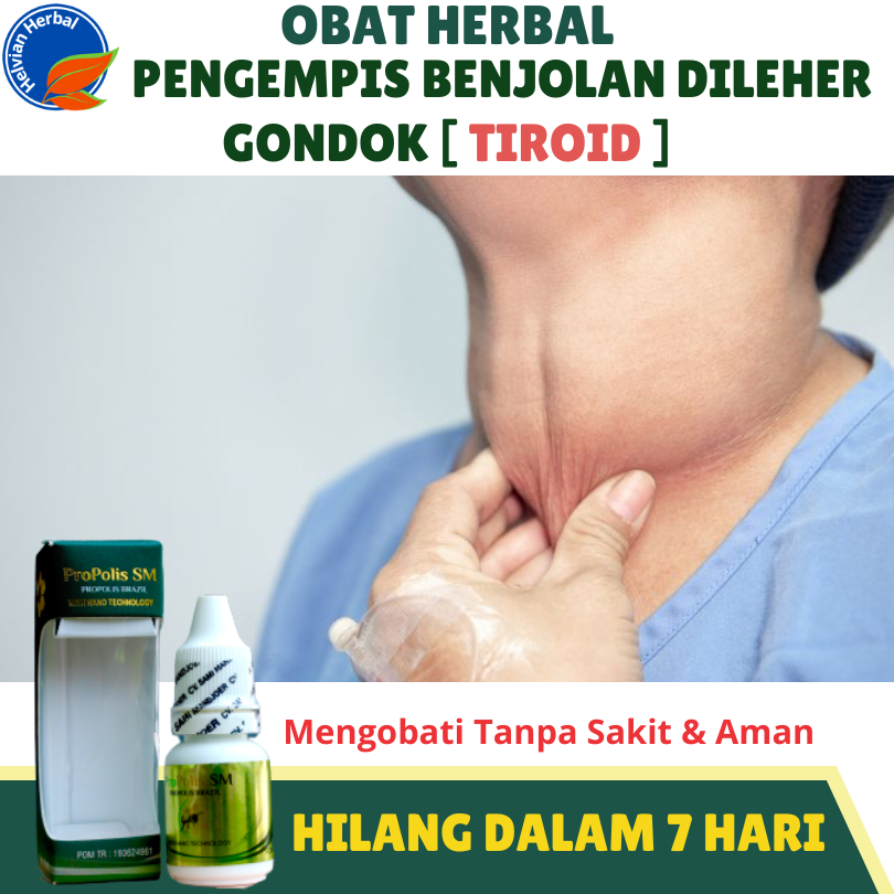 Jual Obat Oles Tiroid Gondok, Kelenjar Tiroid, Gondokan Pengmpis Gondok ...