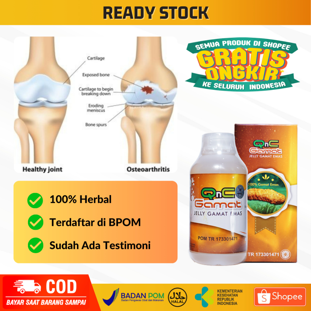 Jual Obat Pengapuran Tulang Lutut dan Sakit Sendi, Obat Nyeri Lutut ...