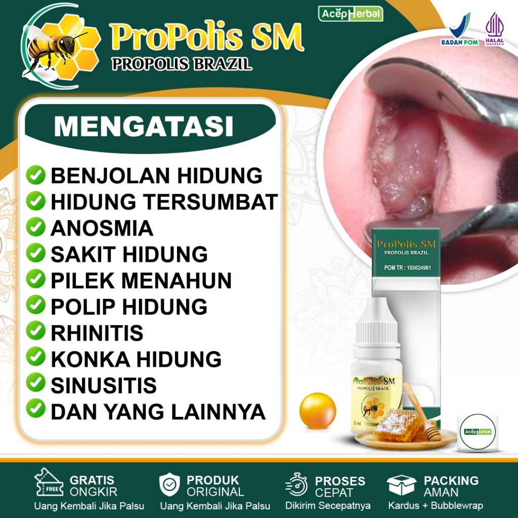 Jual Obat Polip Hidung Benjolan Di Hidung Anosmia Hidung Tersumbat ...