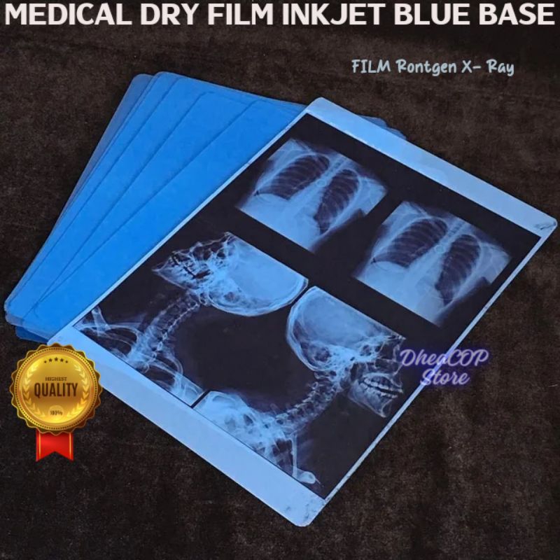 Jual Medical Dry Film Inkjet Rontgen X-ray Radiology A4 Blue Base 100 ...