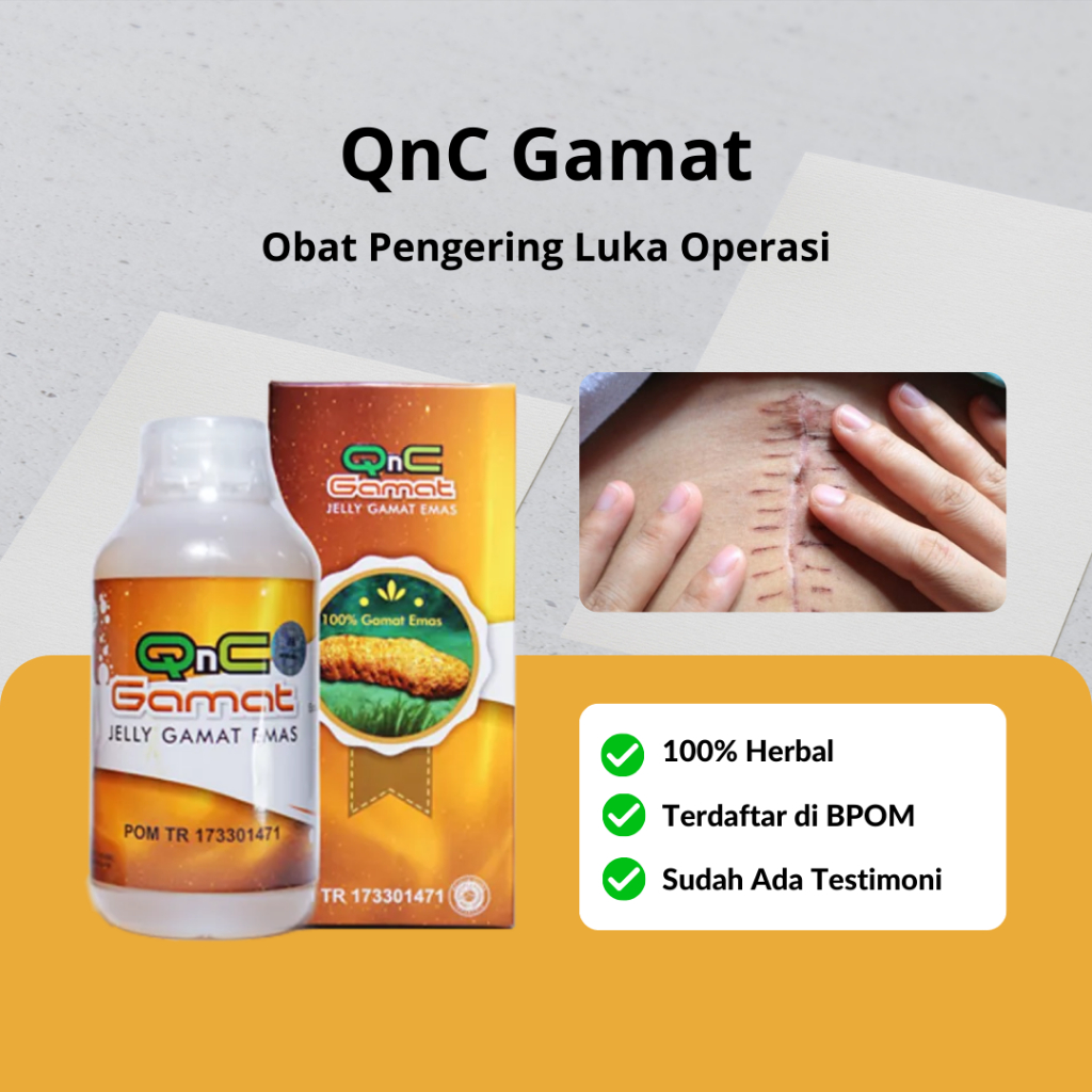Jual QnC Gamat - Obat Pengering Luka Pasca Operasi Caesar, Obat Luka ...