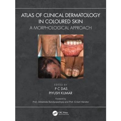 Jual Atlas of Clinical Dermatology in Coloured Skin | Shopee Indonesia