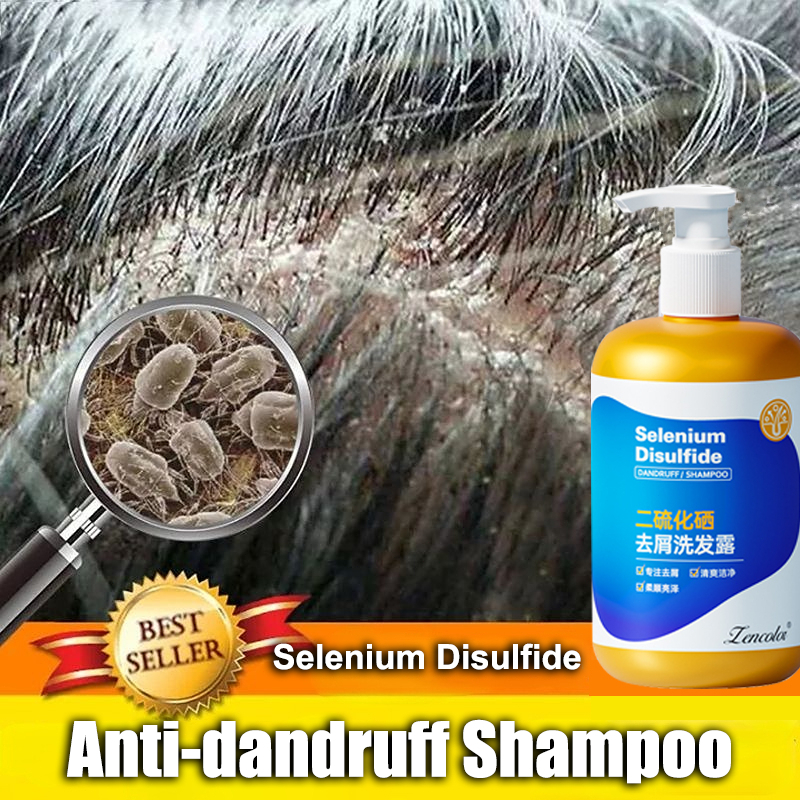 Jual Obat ketombe Sampo ketombe Obat Ketombe Rambut Rontok Berkerak Sampo 300ML Efesiensi ...