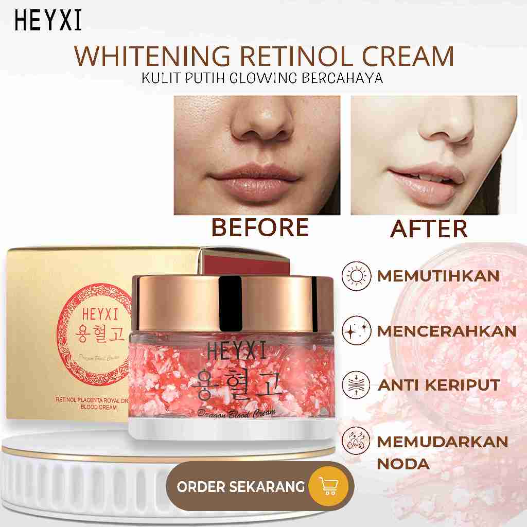 Jual HEYXI Retinol Cream Hyaluronic Acid | Krim Retinol Krim Pelembab ...