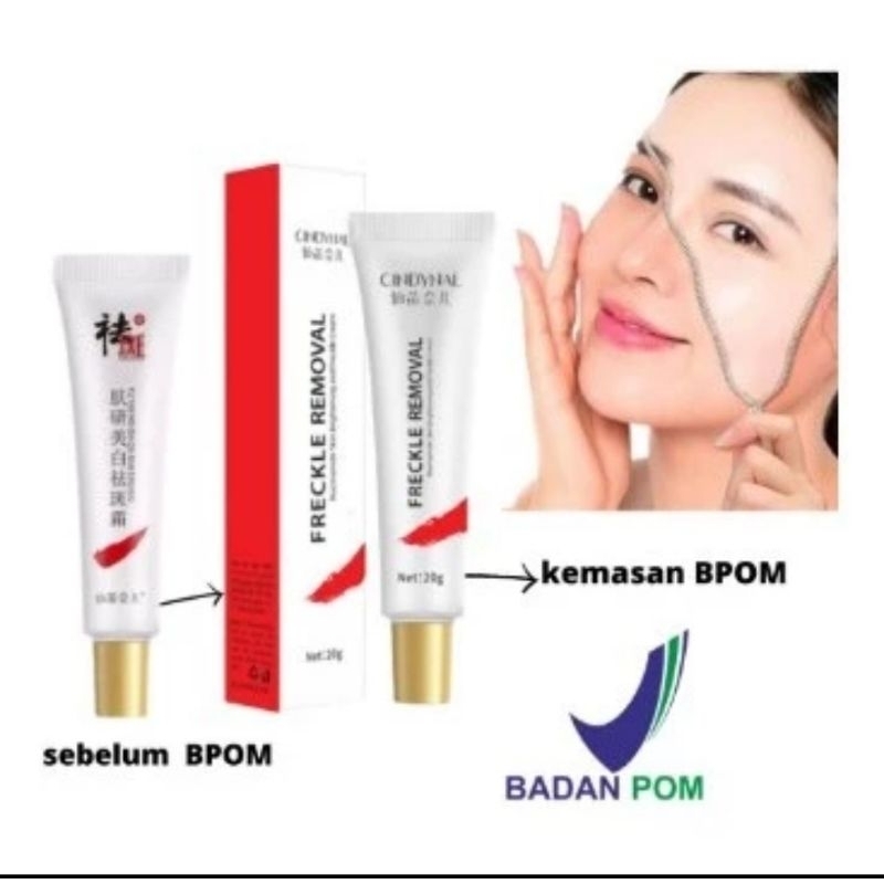 Jual CINDYNAL FLEK HITAM NIACINAMIDE SKIN CREAM BPOM | Shopee Indonesia