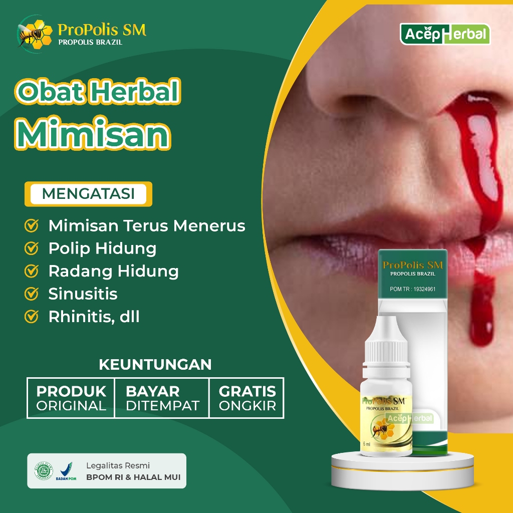 Jual Obat Sering Mimisan Epistaksis Polip Radang Hidung Sinusitis ...