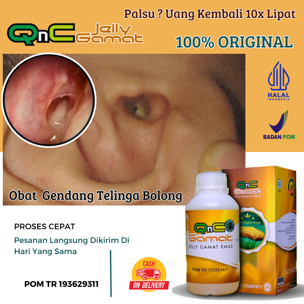 Jual Obat Herbal Gendang Telinga Bolong Pecah, Bernanah Qnc Jelly Gamat Asli | Shopee Indonesia