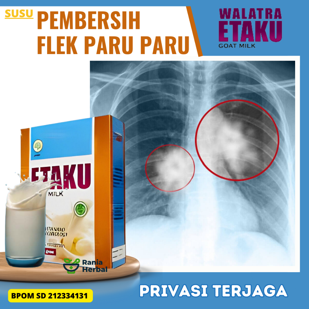 Jual Obat Flek Paru Paru, Obat Batuk Berdarah, Obat Asma Sesak Nafas ...