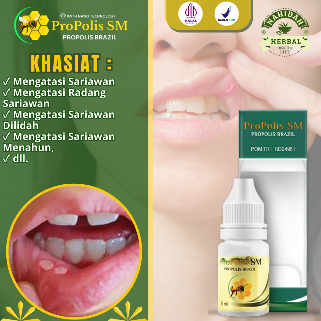 Jual Obbat Sariawan, Obat Tetes Sariawan, Bibir Pecah Pecah Obat ...