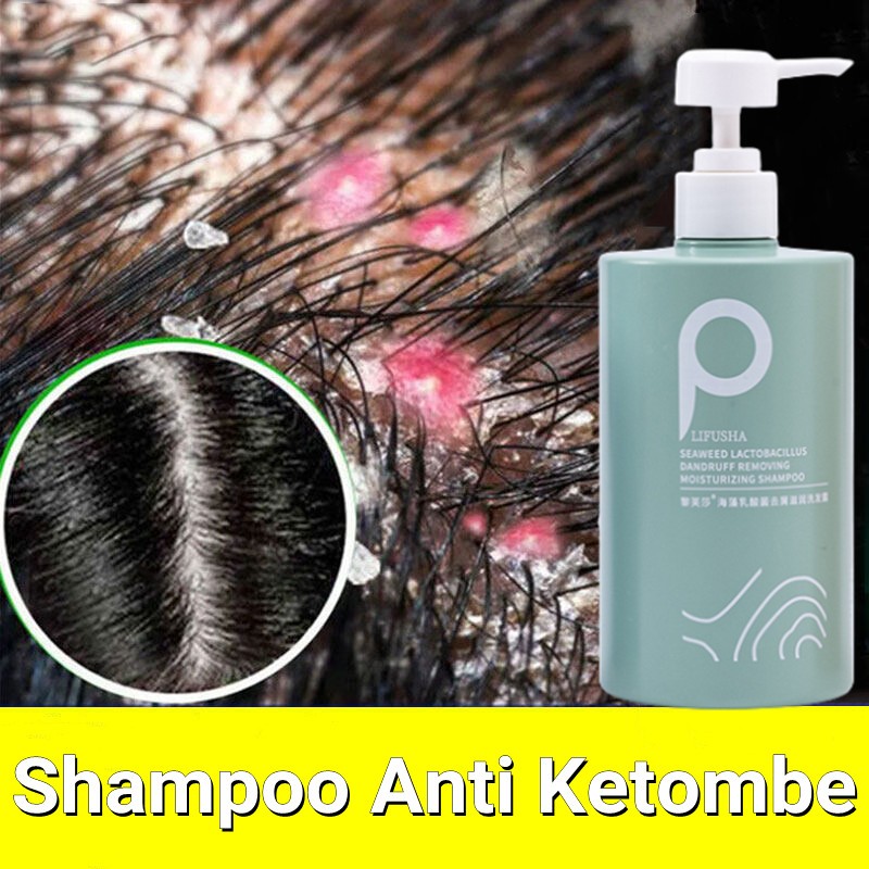 Jual Shampoo Anti Ketombe Penghilang Ketombe Sampo Garam Laut Ketombe Rambut Berkerak Anti ...