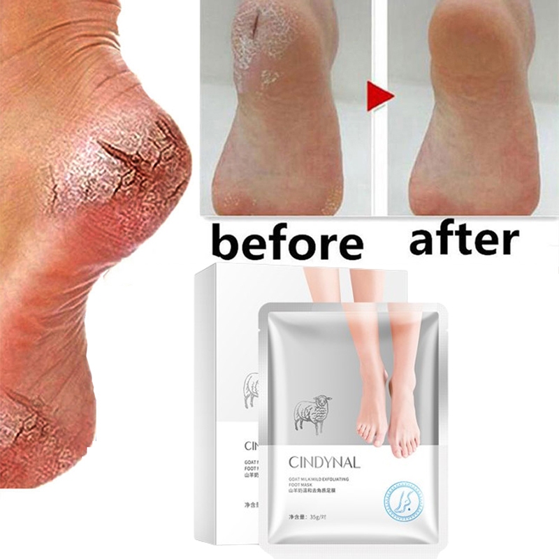 Jual Masker kaki Foot Mask masker kaki pengelupas kulit mati Kering dan ...