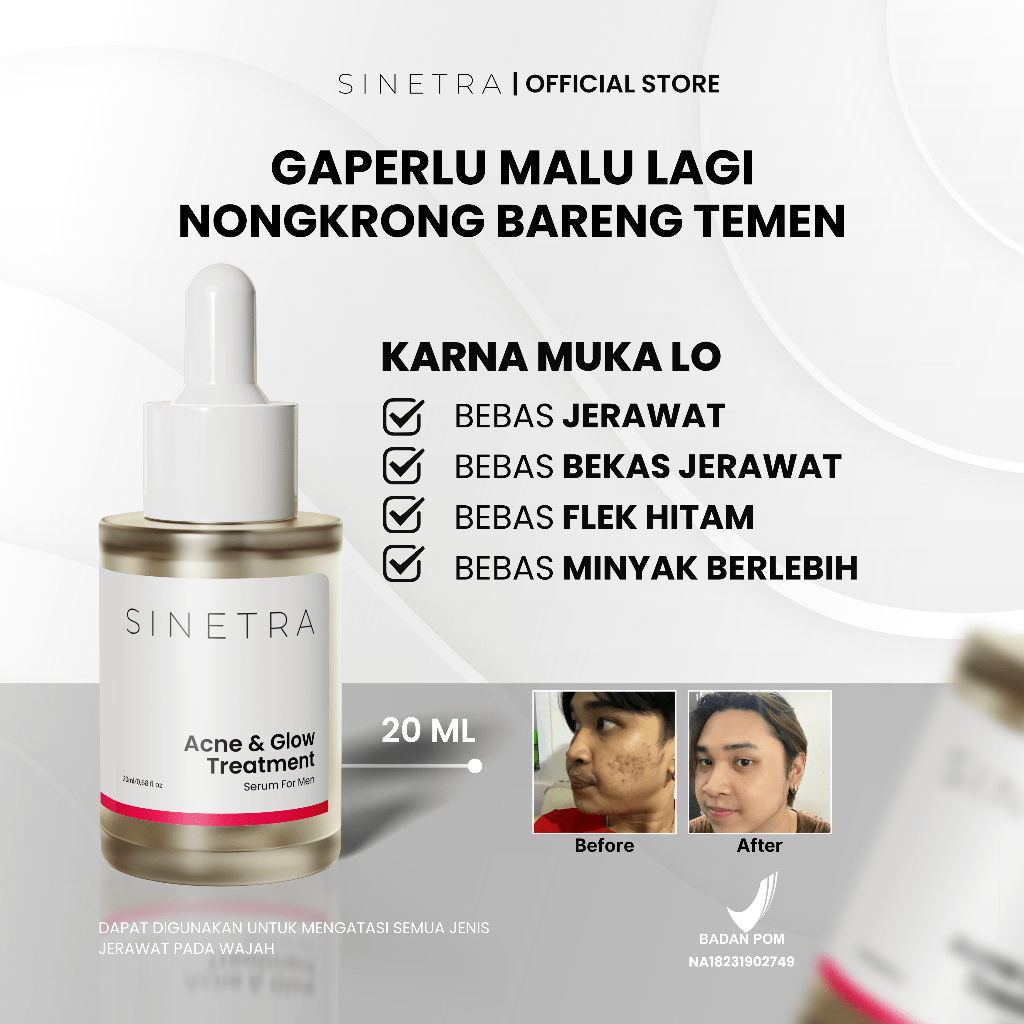 Jual Sinetra Acne & Glow Treatment Serum | Serum Anti Jerawat - 20ml ...