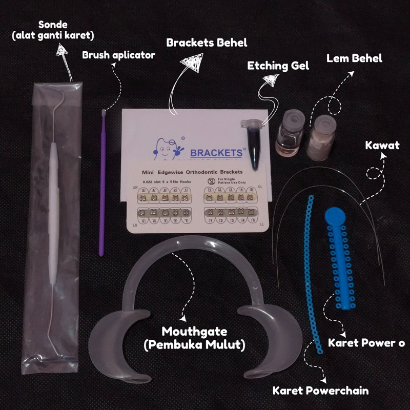 Jual paket behel permanen bisa pasang sendiri // paket super lengkap ...