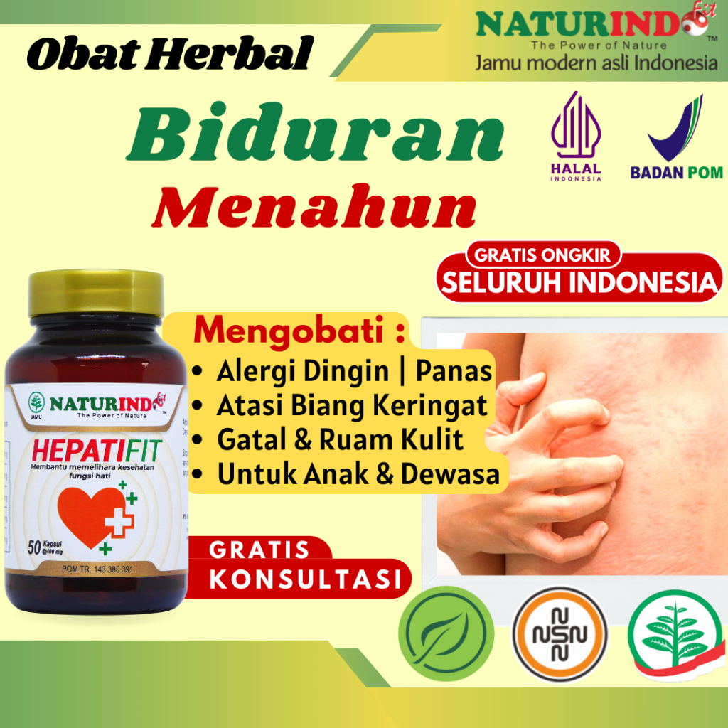 Jual Obat Biduran Alergi Dingin Dan Panas Gatal Biang Keringat Ruam ...