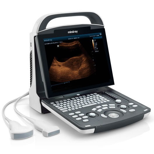 Jual USG DP10 2D Doppler/Mindray DP 10/Alat Usg Dan Probe | Shopee ...