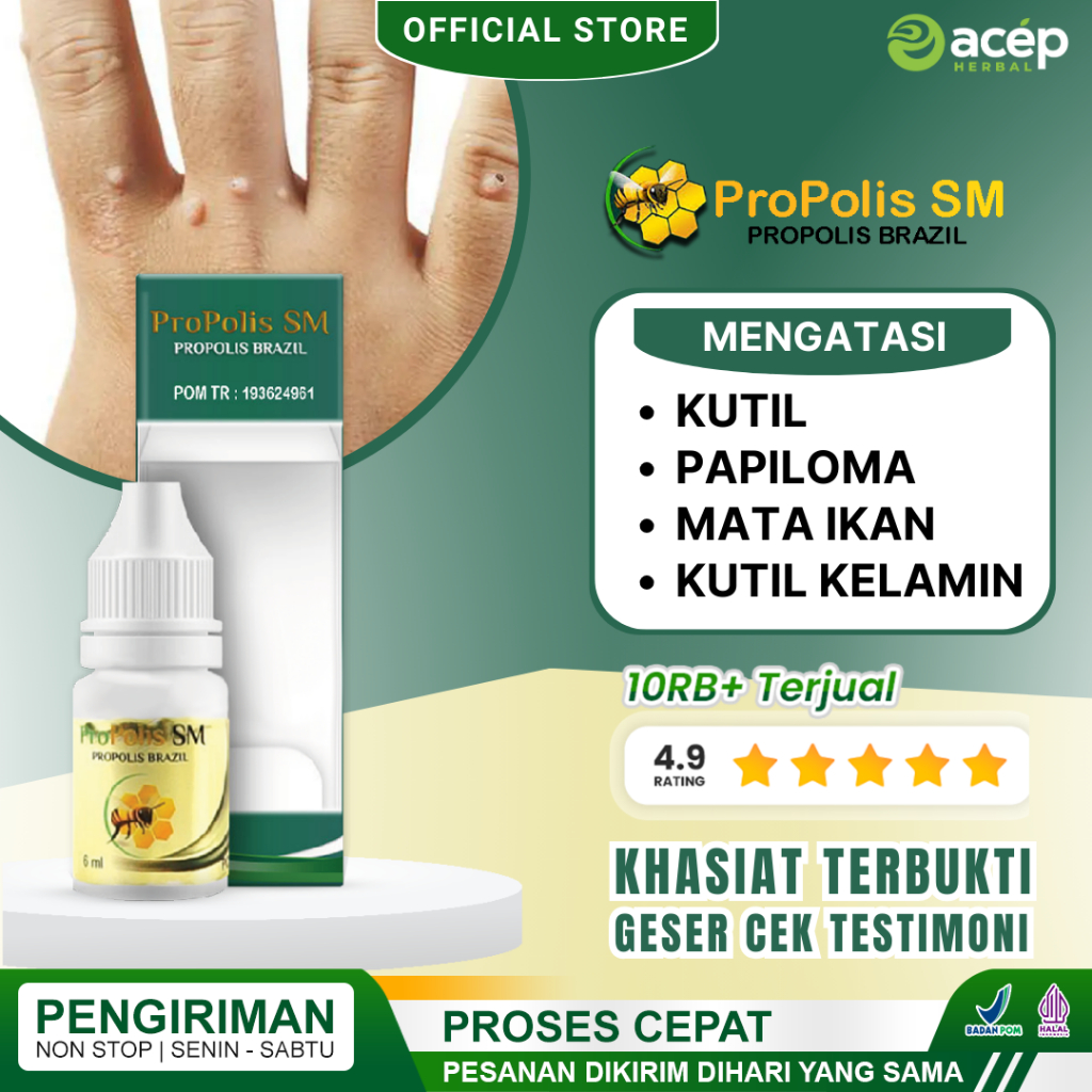 Jual Obat Penghilang Kutil Mata Ikan Atasi Kutil Kelamain dan Papiloma ...