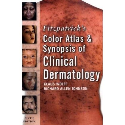 Jual Fitzpatrick's Color Atlas and Synopsis of Clinical Dermatology ...