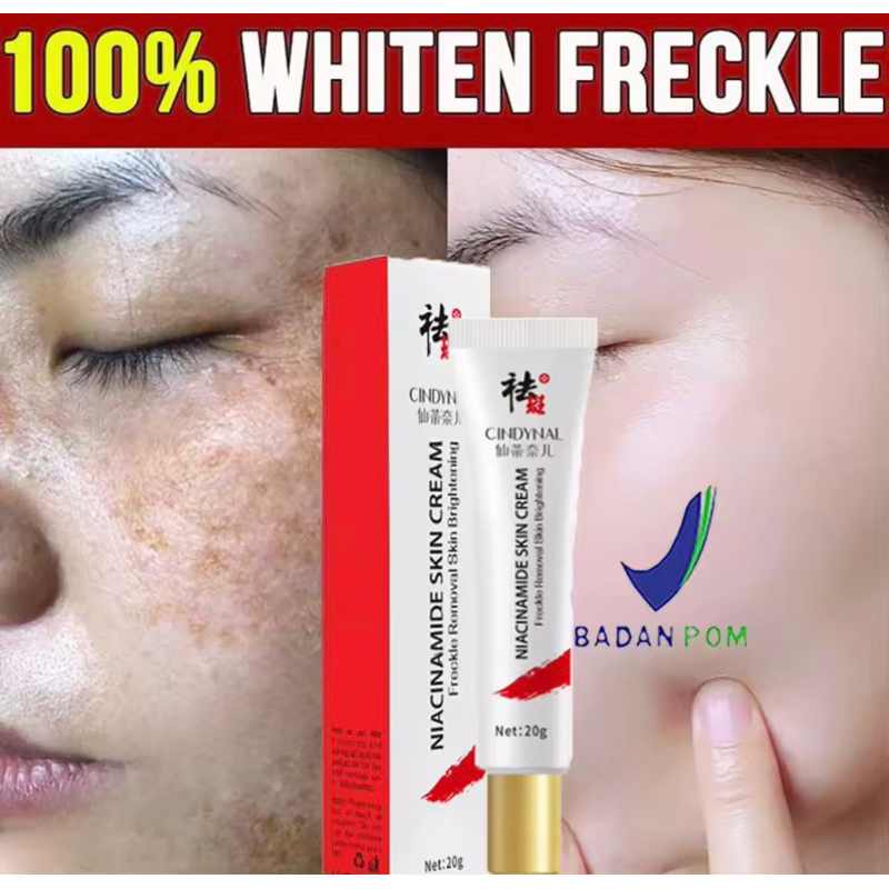 Jual COD (GRATIS ONGKIR) Skin Cream Cindynal Niacinamide Salep Jerawat dan flek hitam By RJMoon ...