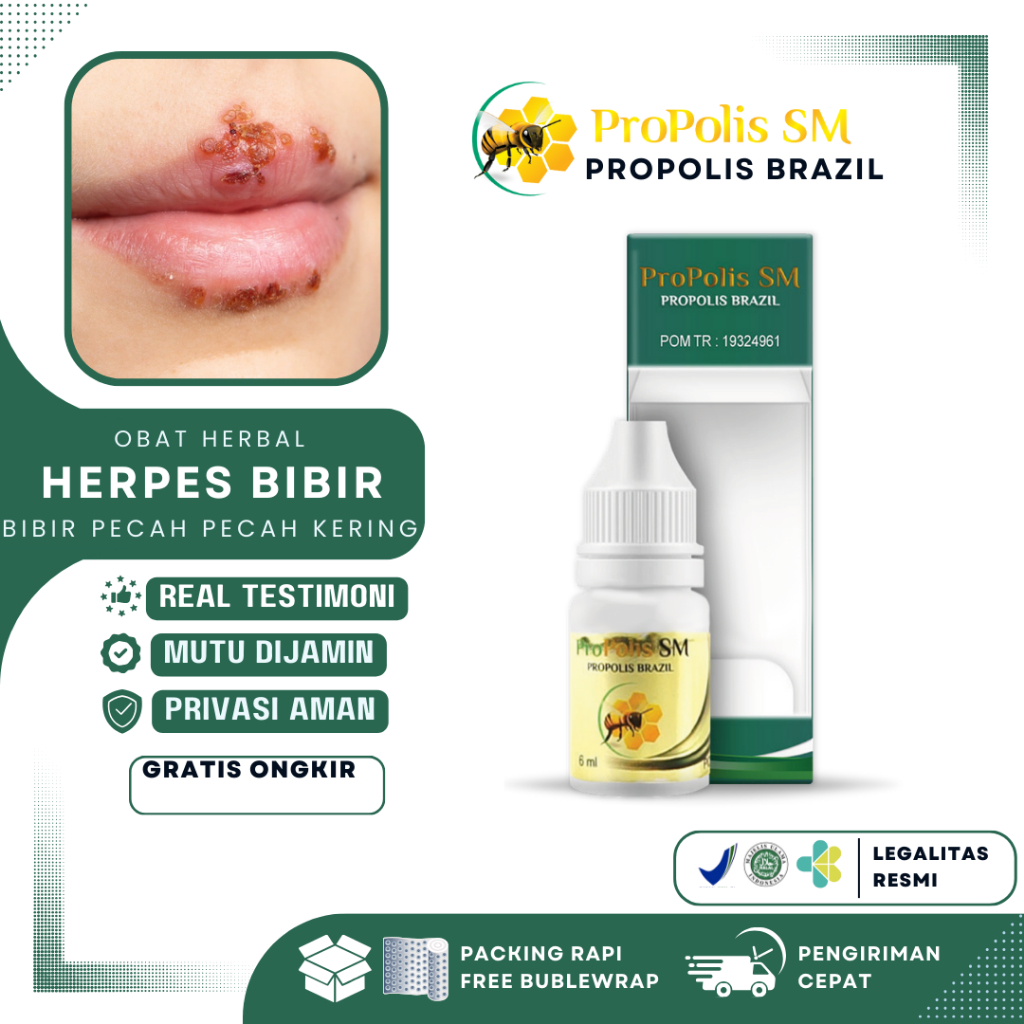 Jual Obat Herpes Bibir, Obat Herpes Zosper, Obat Bintik Bintik di Bibir ...