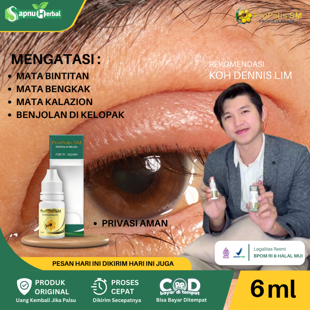 Jual Obat Mata Bintitan, Obat Buat Mata Bintitan, Obat Mata Kalazion ...